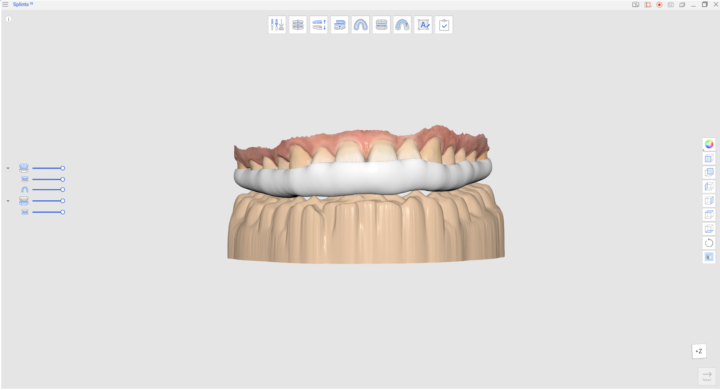 Dynamic Occlusion 데이터를 이용한 스플린트 제작 – 메디트 고객지원센터
