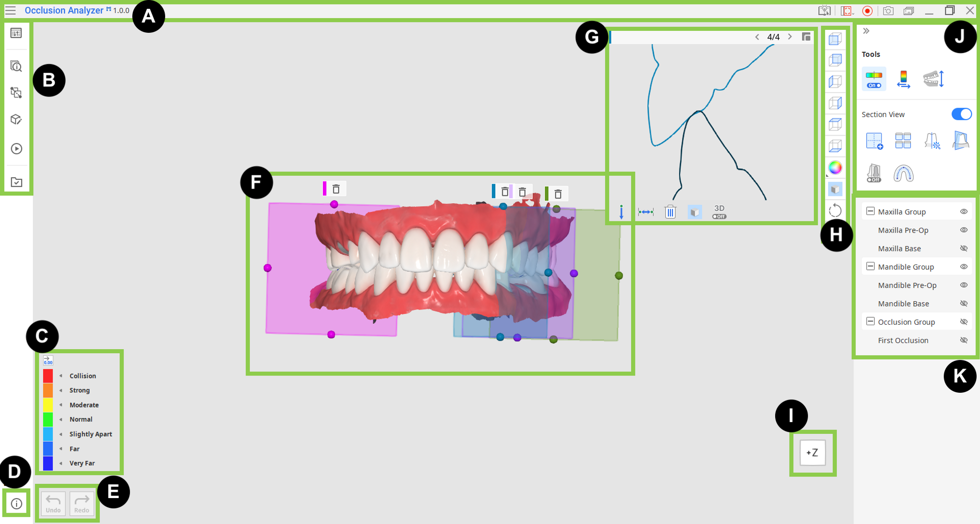 ユーザーインターフェース – Medit Help Center