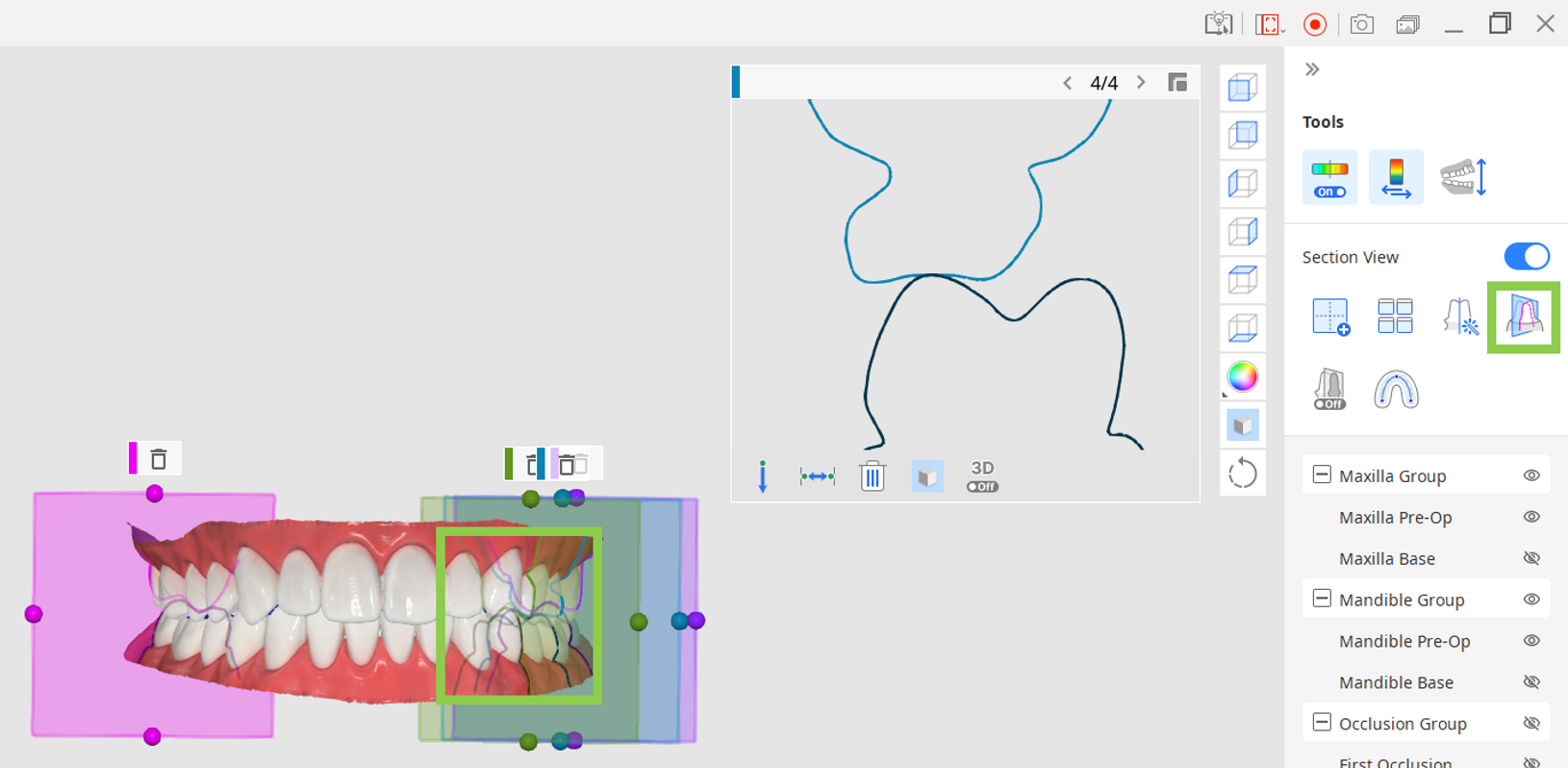 Overview Mode – Medit Help Center