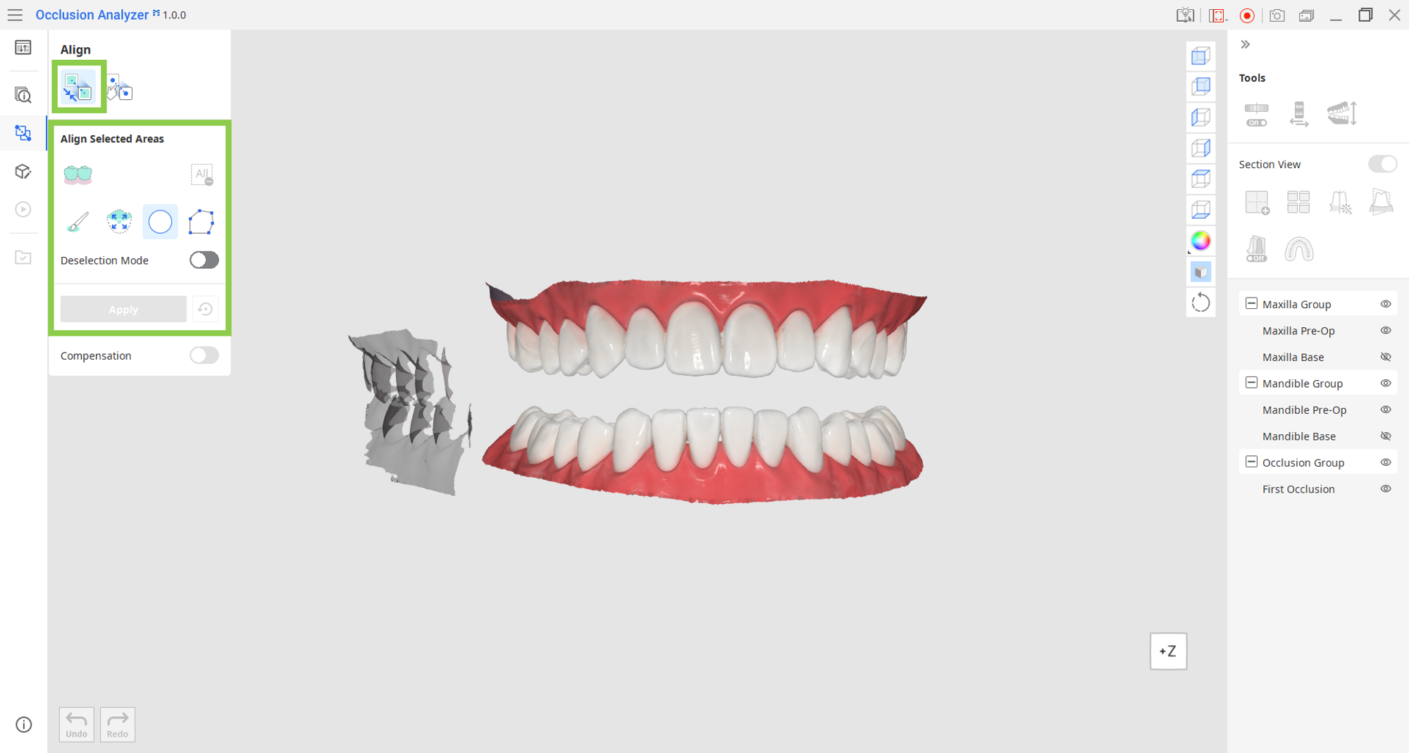 Alignment Mode – Medit Help Center