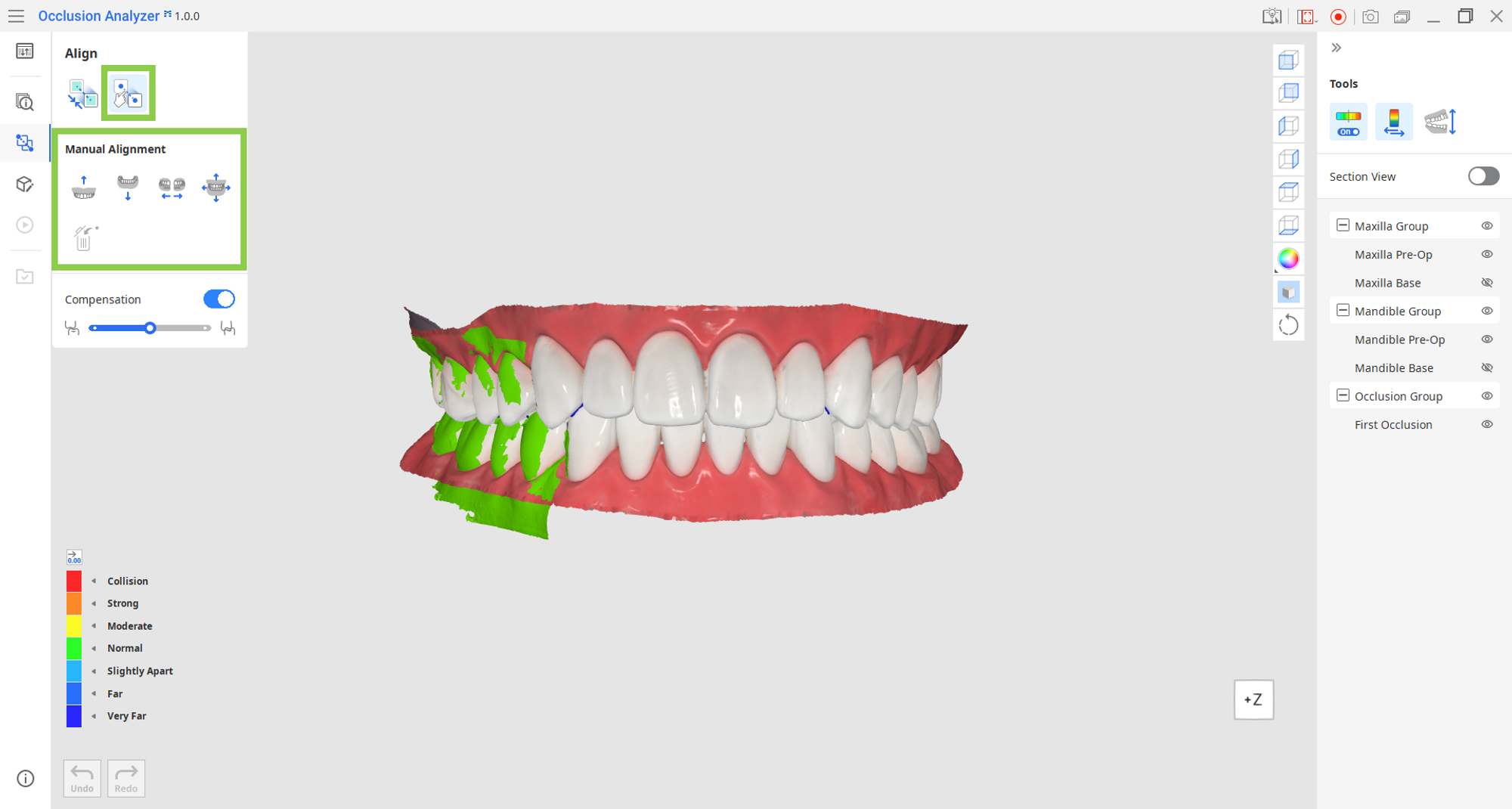 Alignment Mode – Medit Help Center