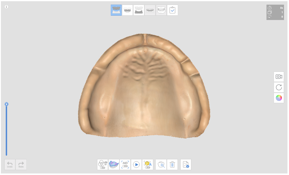 Edentulous maxilla scan – Medit Help Center