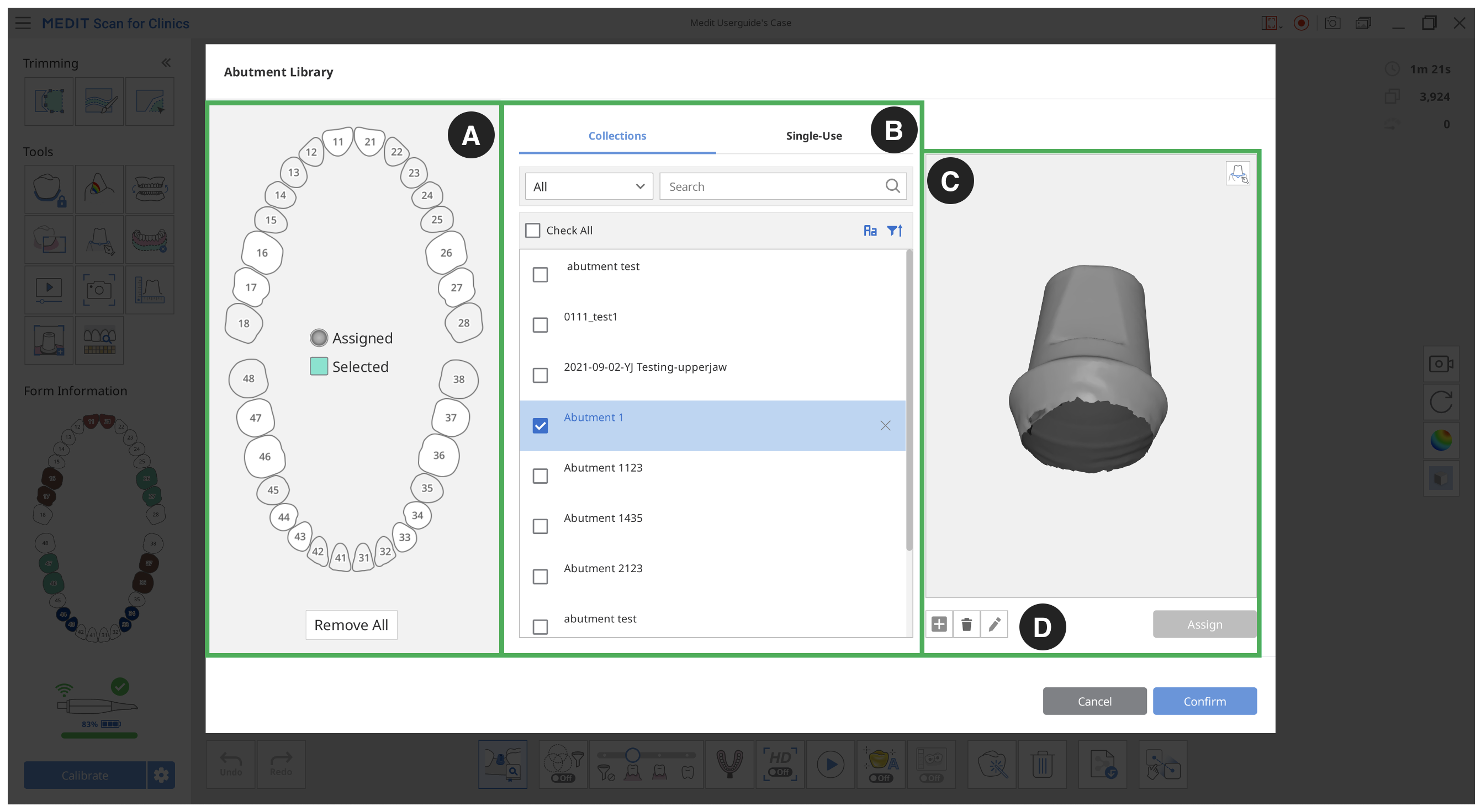 🔍 Manage abutment library – Medit Help Center
