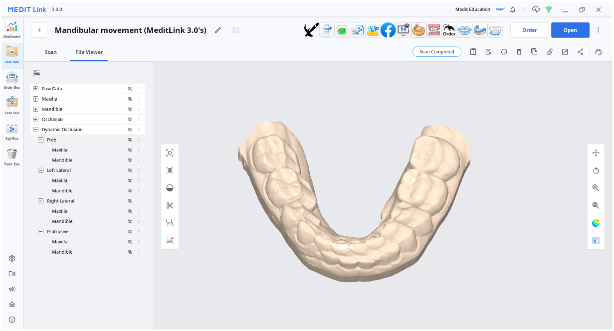 🔍 Use of Dynamic Occlusion Data in exocad – Medit Help Center