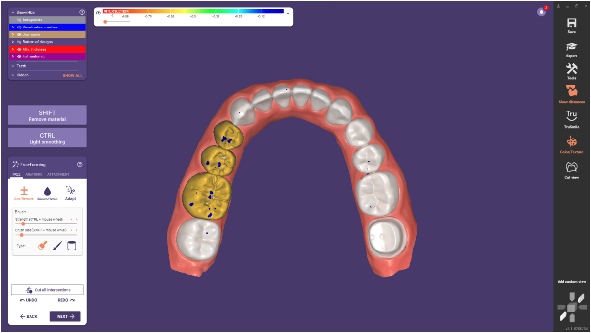 🔍 Use of Dynamic Occlusion Data in exocad – Medit Help Center