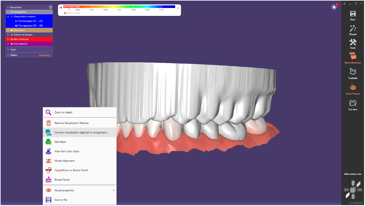 🔍 Use of Dynamic Occlusion Data in exocad – Medit Help Center