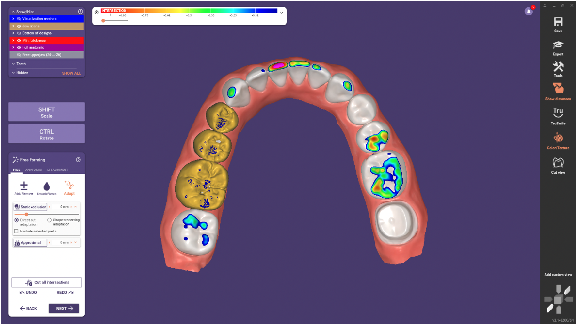🔍 Use of Dynamic Occlusion Data in exocad – Medit Help Center