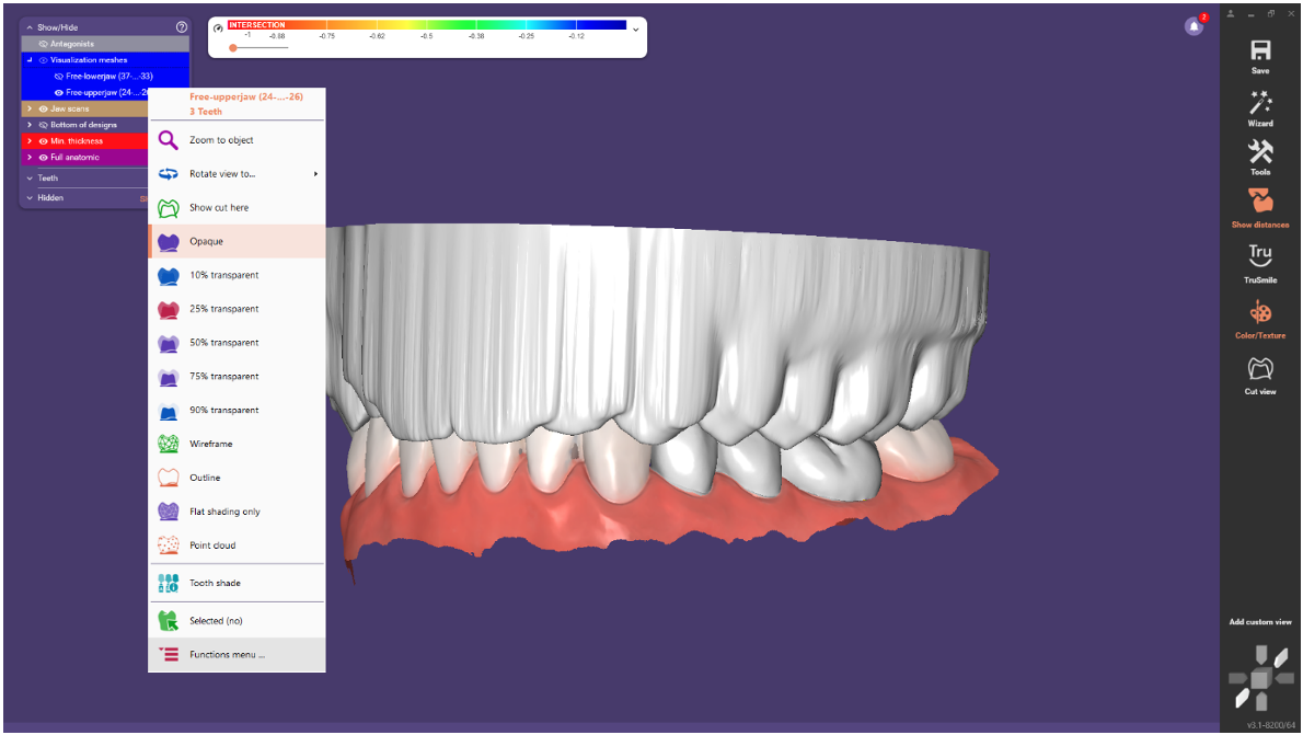 🔍 Use of Dynamic Occlusion Data in exocad – Medit Help Center