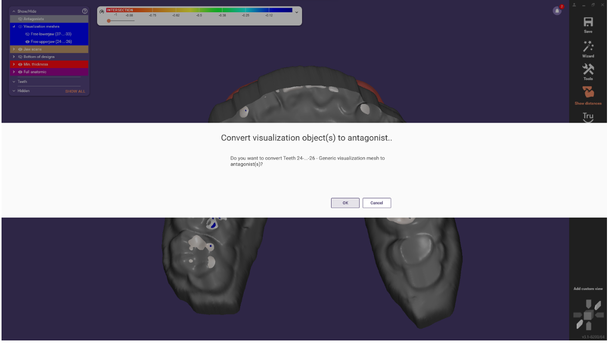🔍 Use of Dynamic Occlusion Data in exocad – Medit Help Center