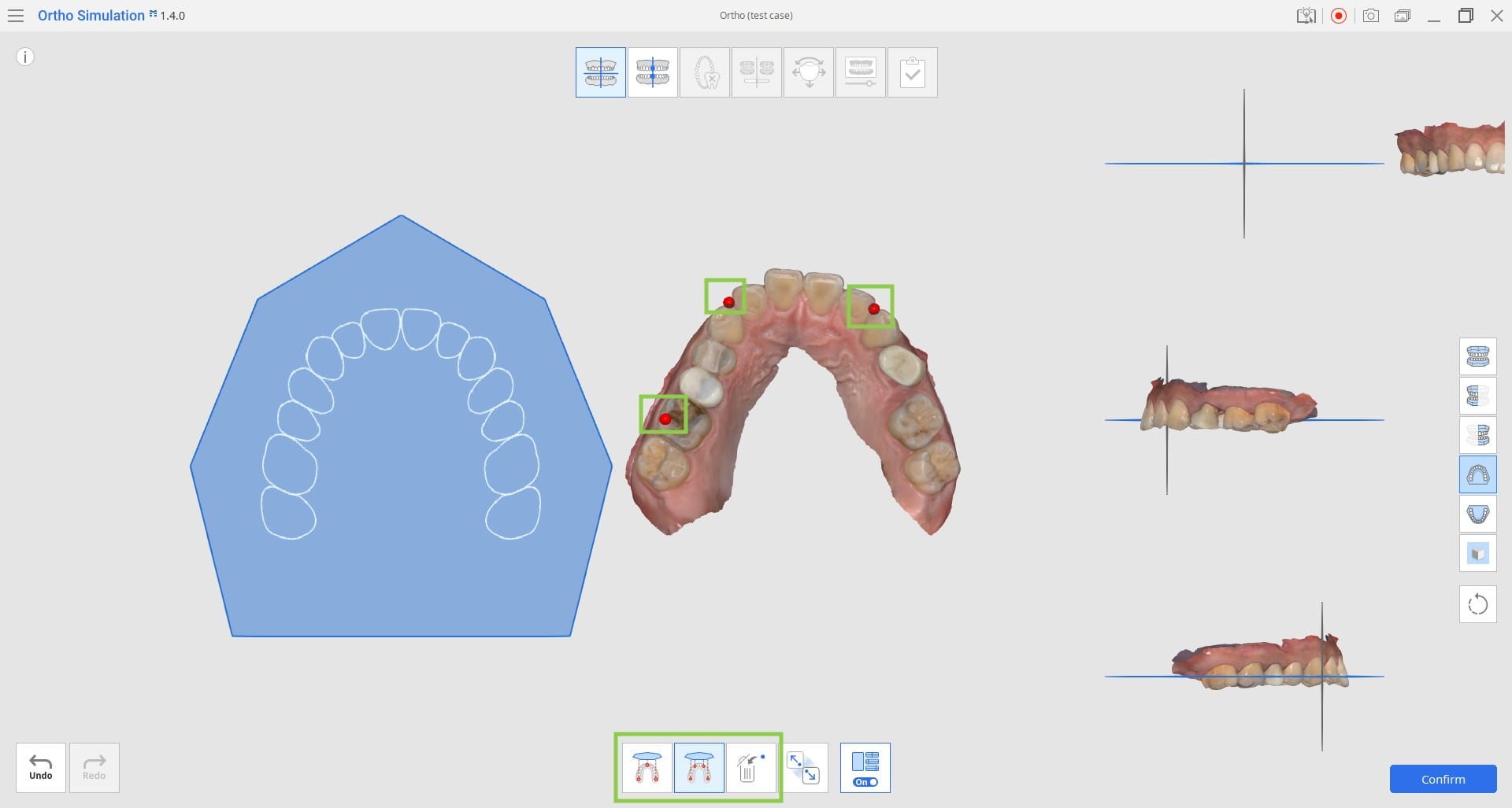 📖 Workflow > Data Alignment – Medit Help Center