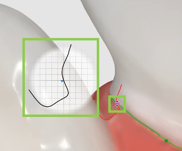 📖 How to Draw Margin Lines – Centre d'aide Medit