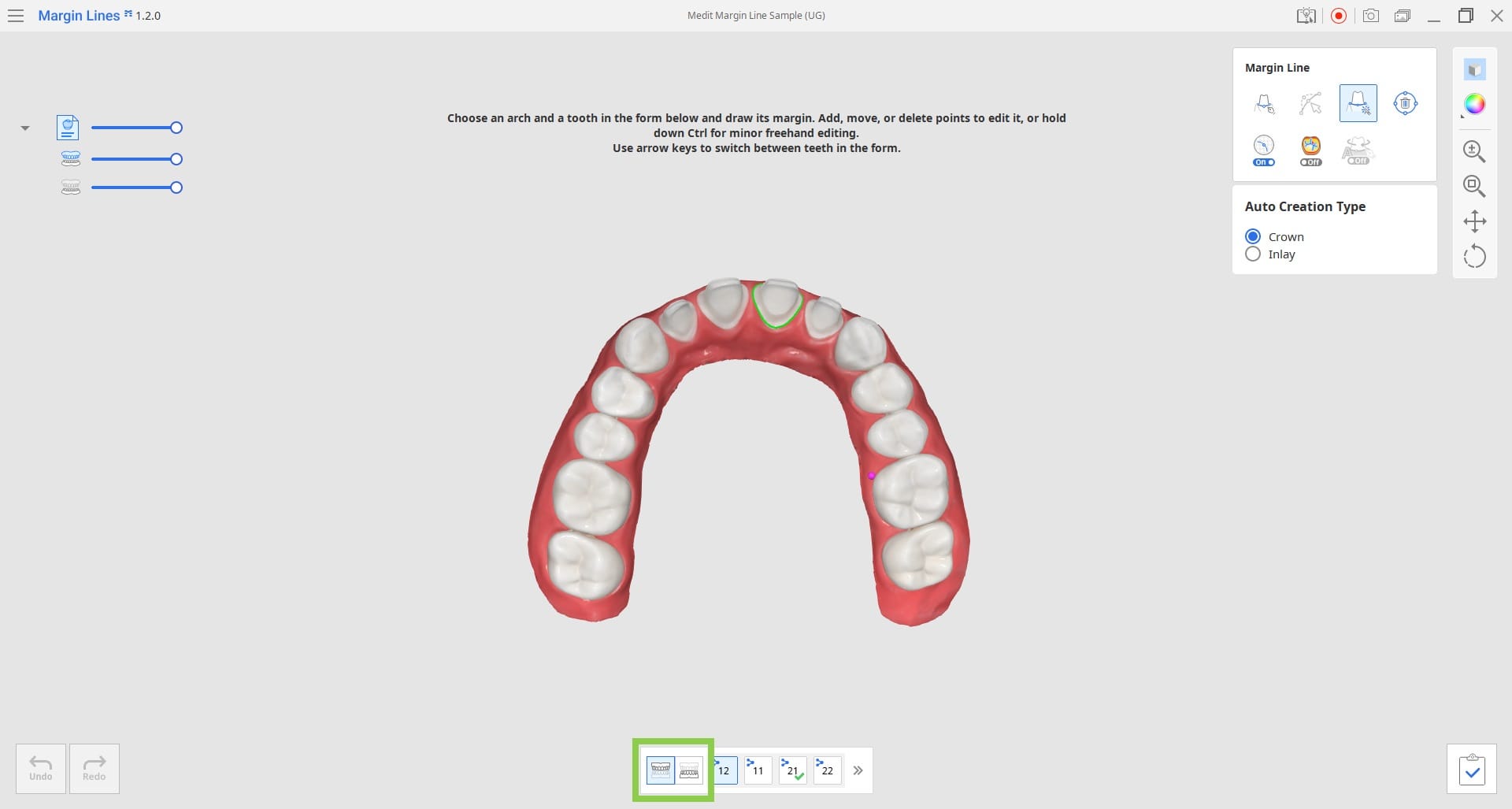 📖 [Margin Lines] Como desenhar linhas de margem – Central de Ajuda do Medit