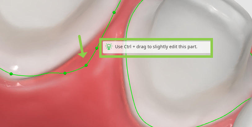 📖 [Margin Lines] Como desenhar linhas de margem – Central de Ajuda do Medit