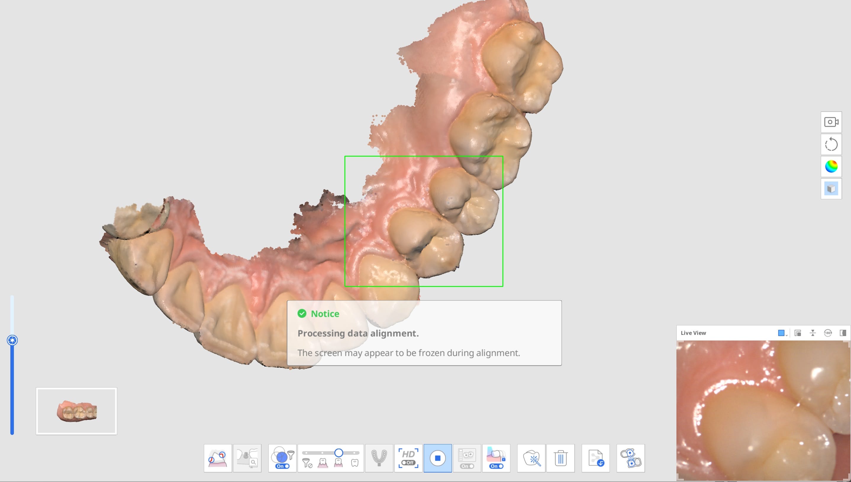 📖 Scan Stage Tools – Medit Help Center