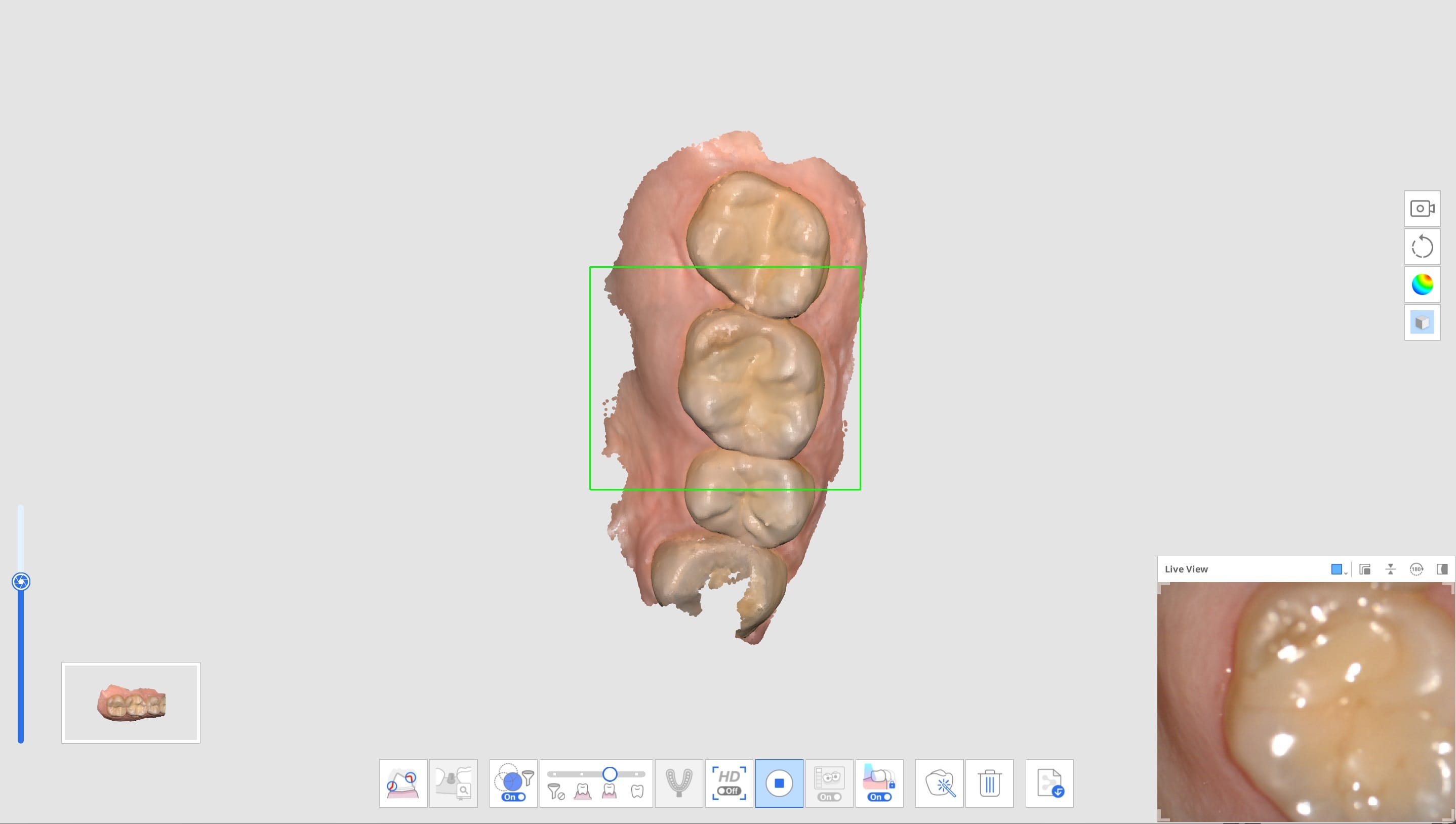 📖 Scan Stage Tools – Medit Help Center