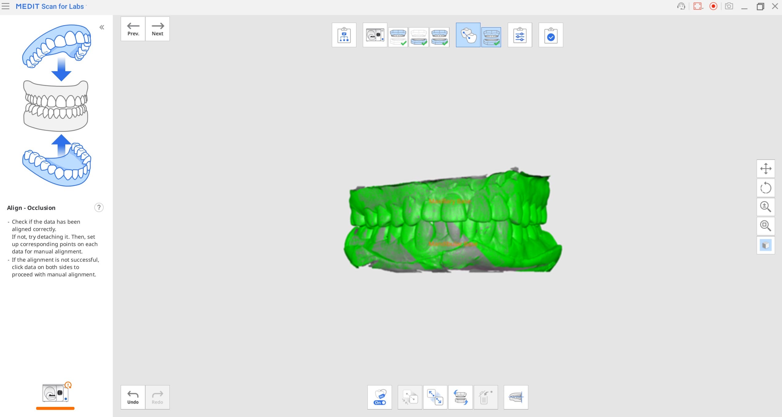📖 Align Data Stage – Medit Help Center