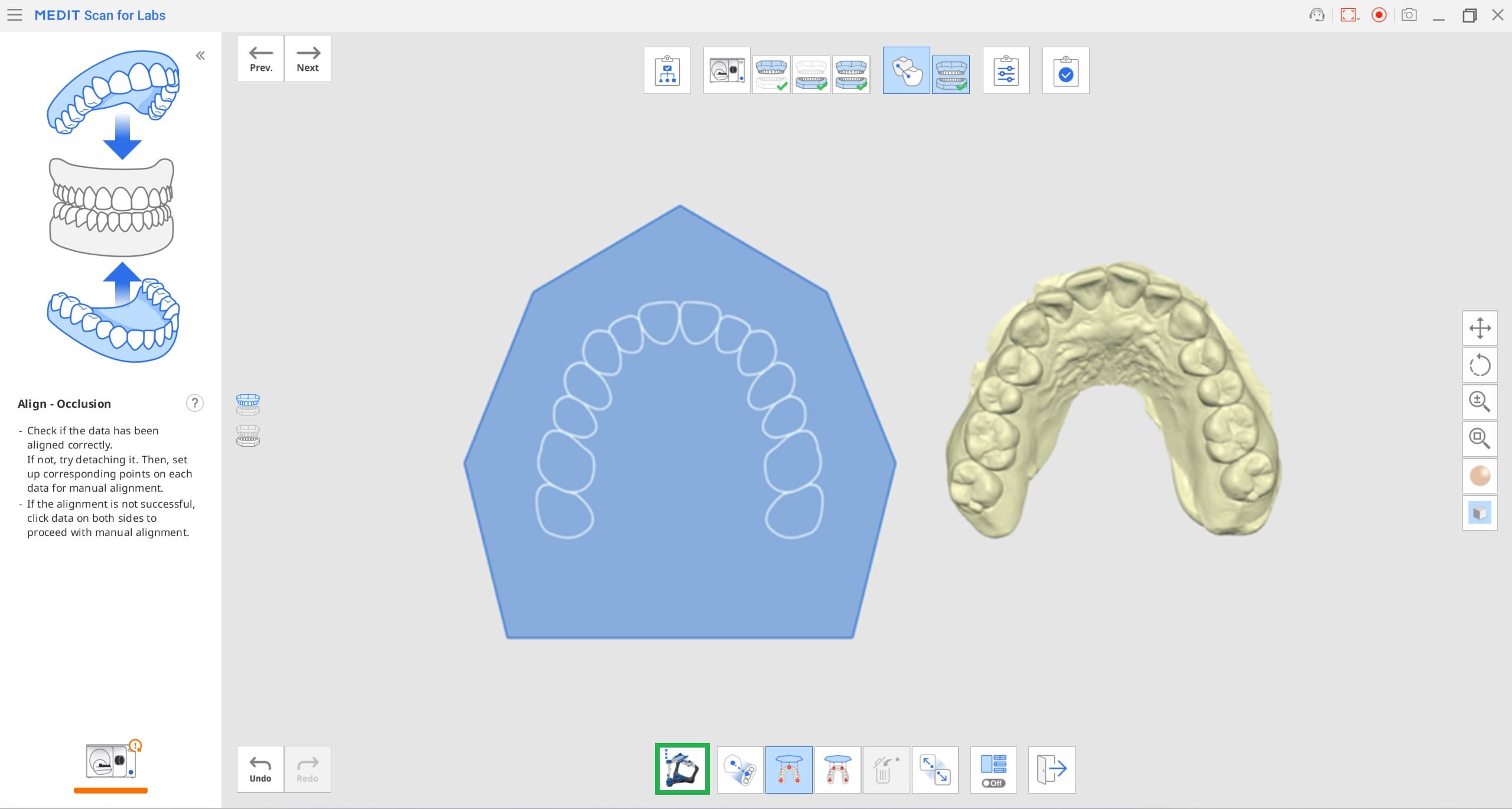 📖 Align Data Stage – Medit Help Center
