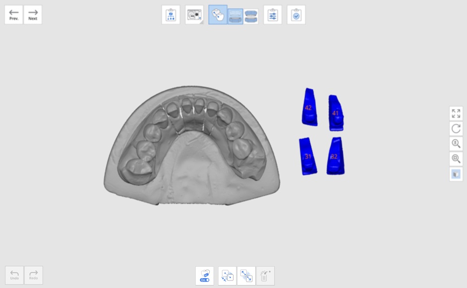 📖 Align Data Stage – Medit Help Center