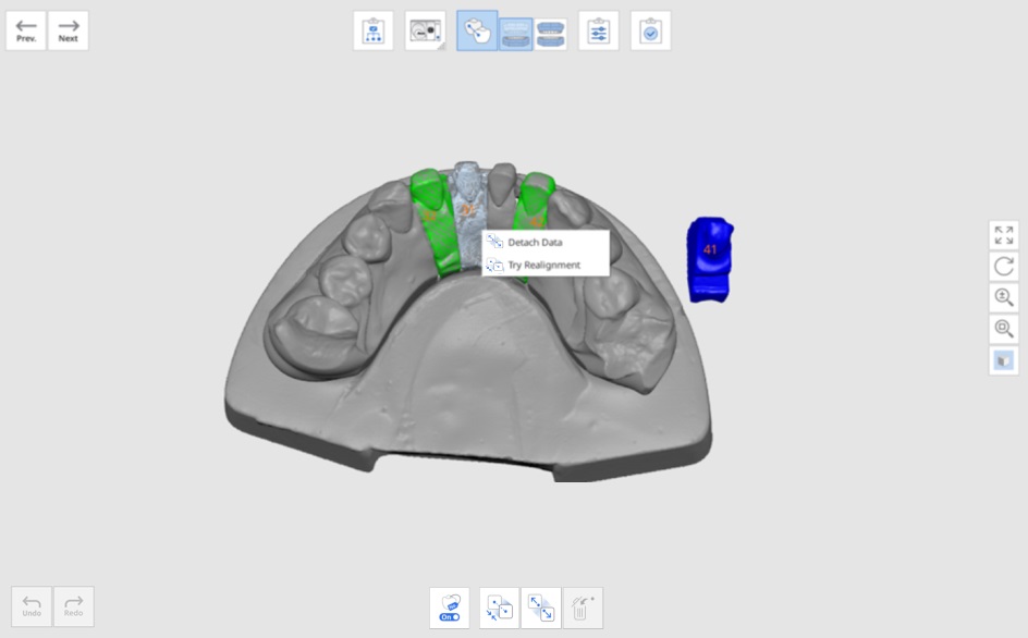 📖 Align Data Stage – Medit Help Center
