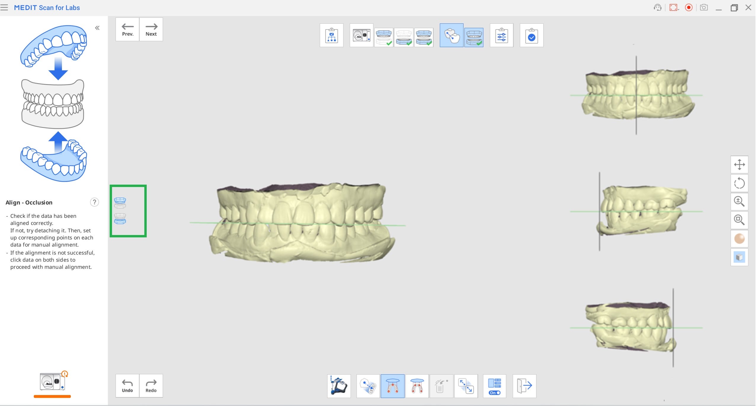 📖 Align Data Stage – Medit Help Center