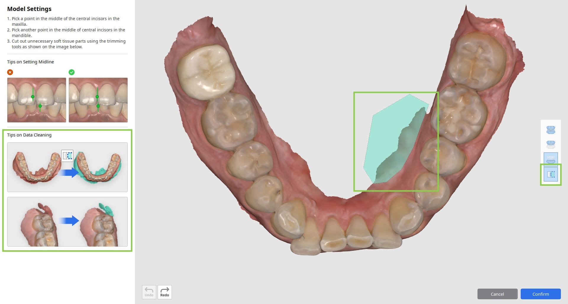 📖 Workflow > Model Settings – Medit Help Center