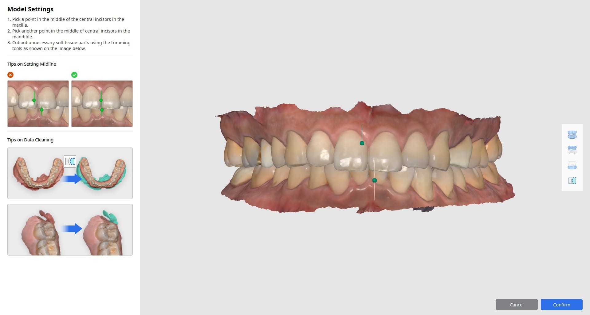 📖 Workflow > Model Settings – Medit Help Center