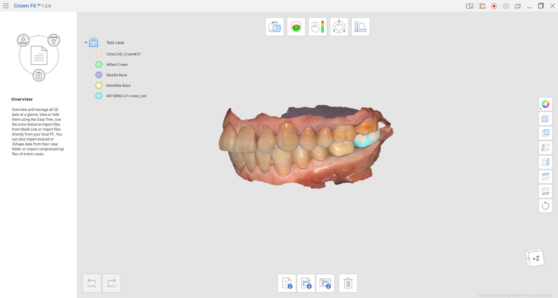 📖 Workflow > Overview – Medit Help Center