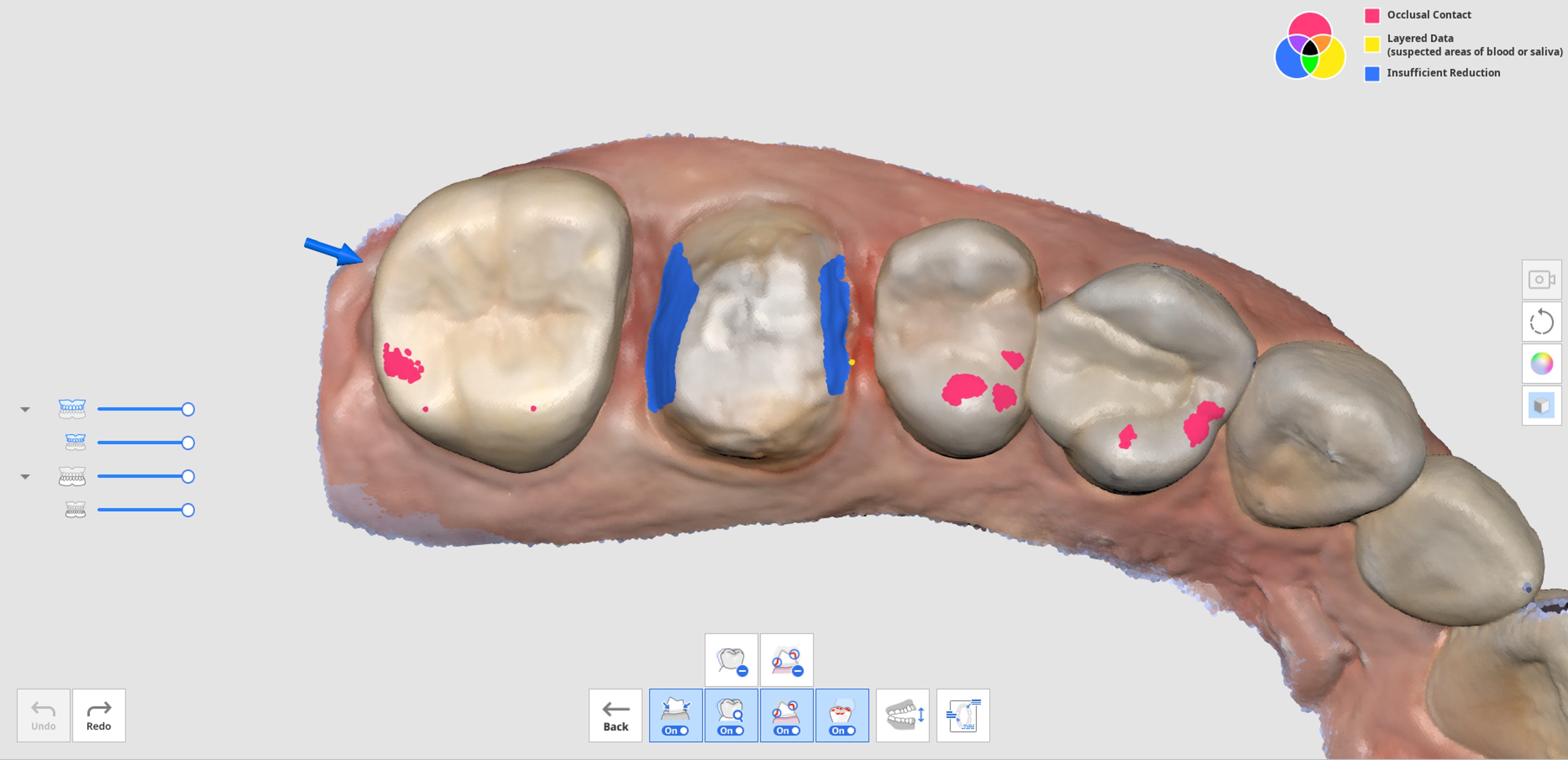 📖 Smart Scan Review – Medit Help Center
