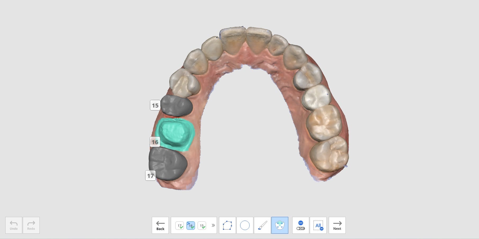 📖 Smart Scan Review – Medit Help Center