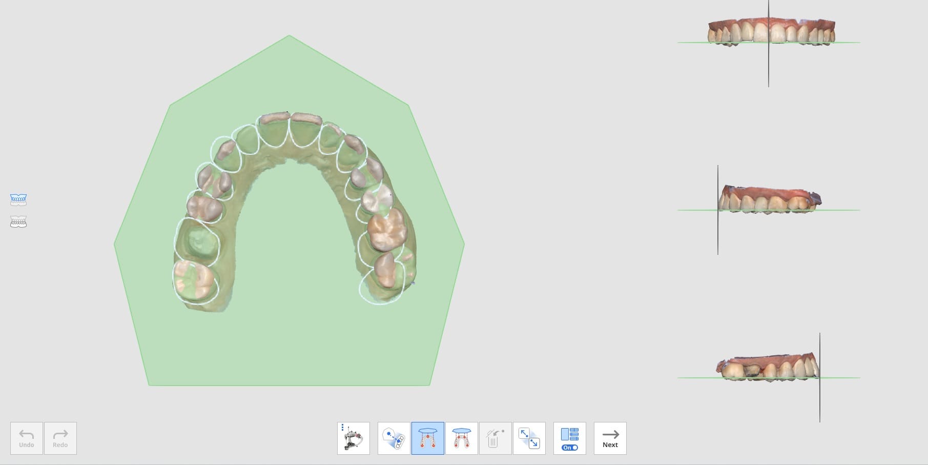 📖 Smart Scan Review – Medit Help Center