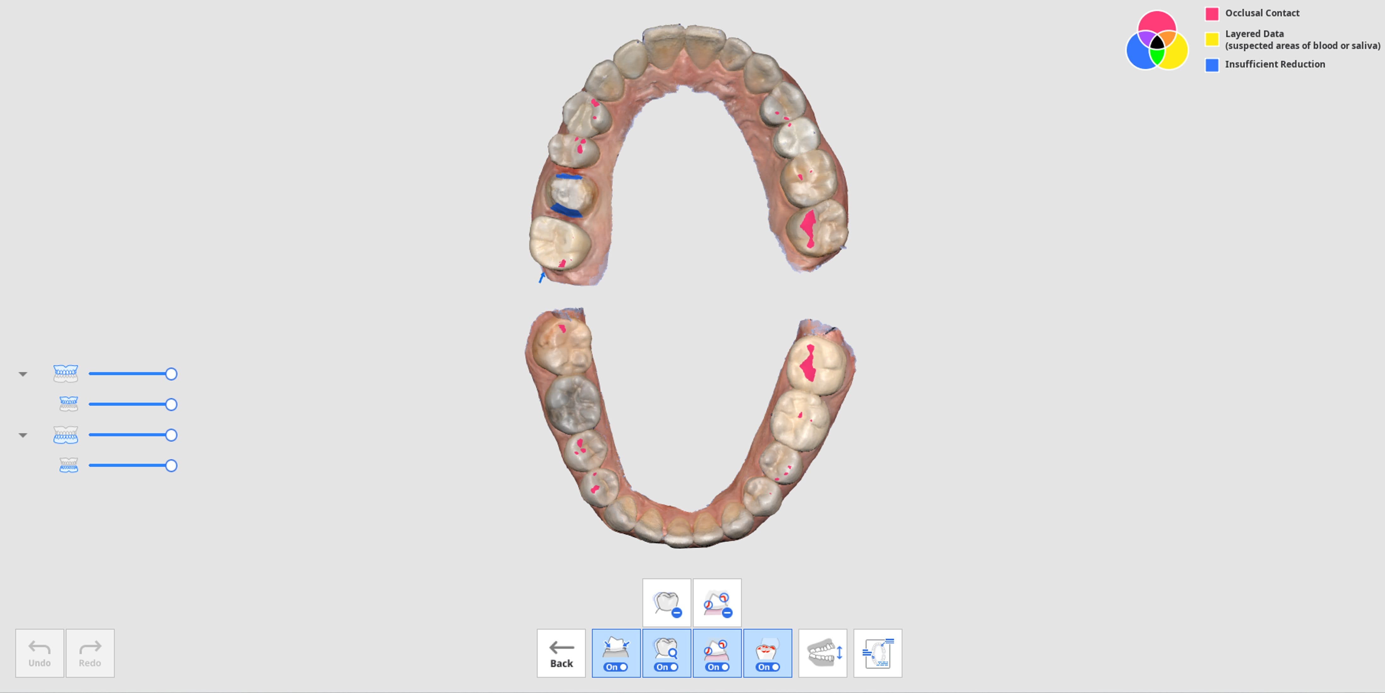 📖 Smart Scan Review – Medit Help Center