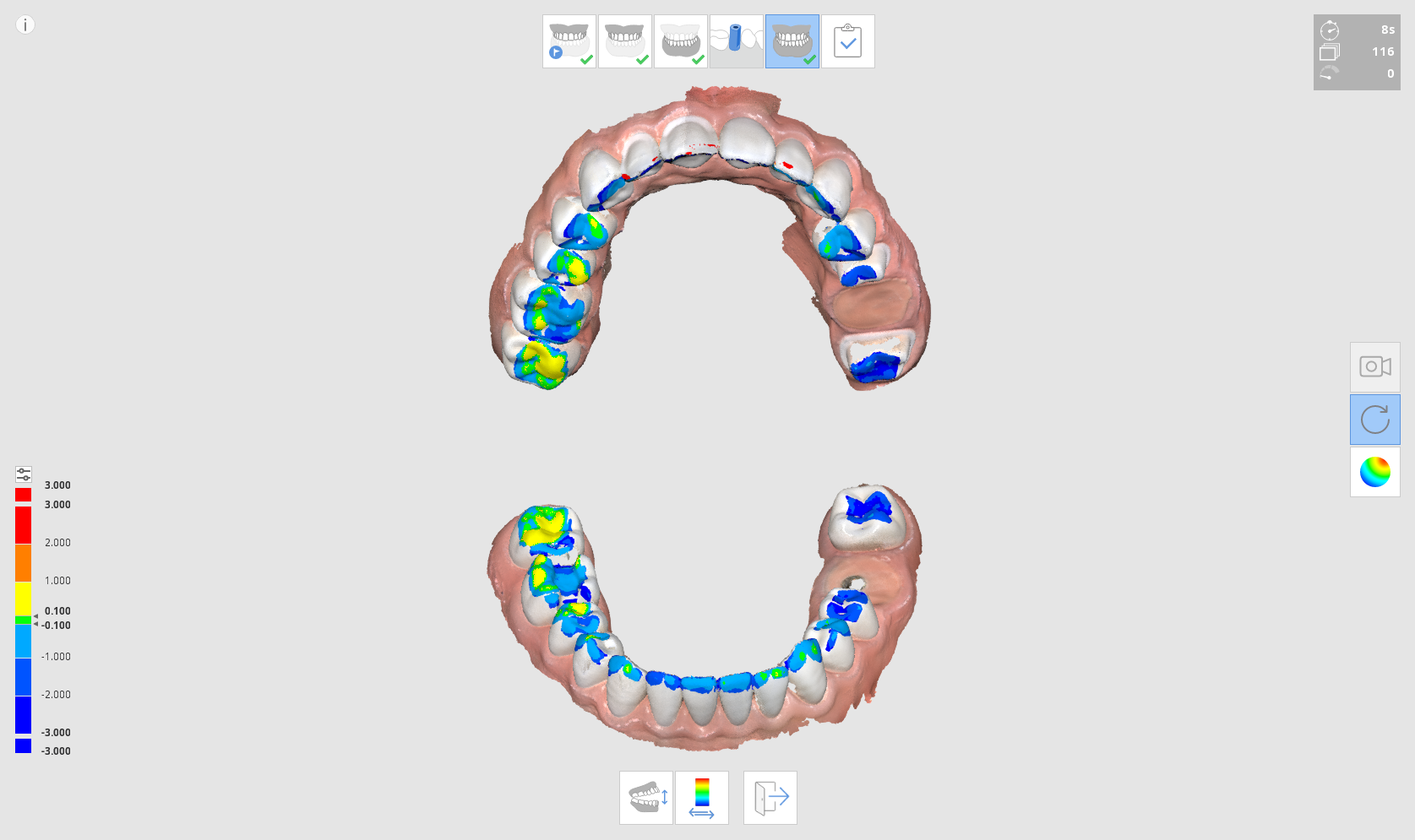 🔍 Occlusion Analysis – Medit Help Center