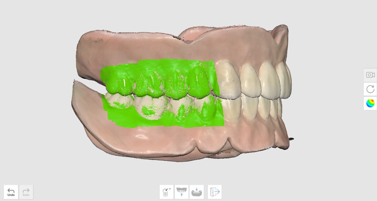 📖 Denture Scan – Medit Help Center