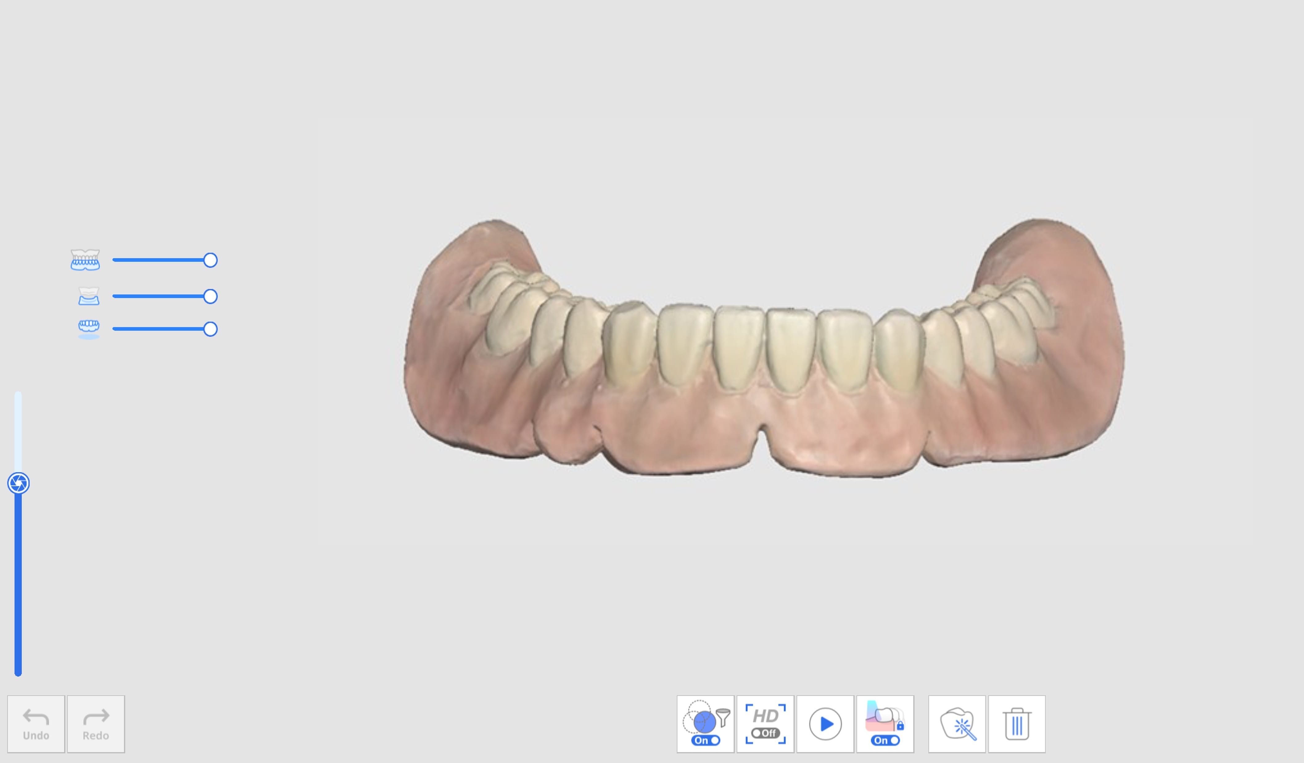 📖 Denture Scan – Medit Help Center
