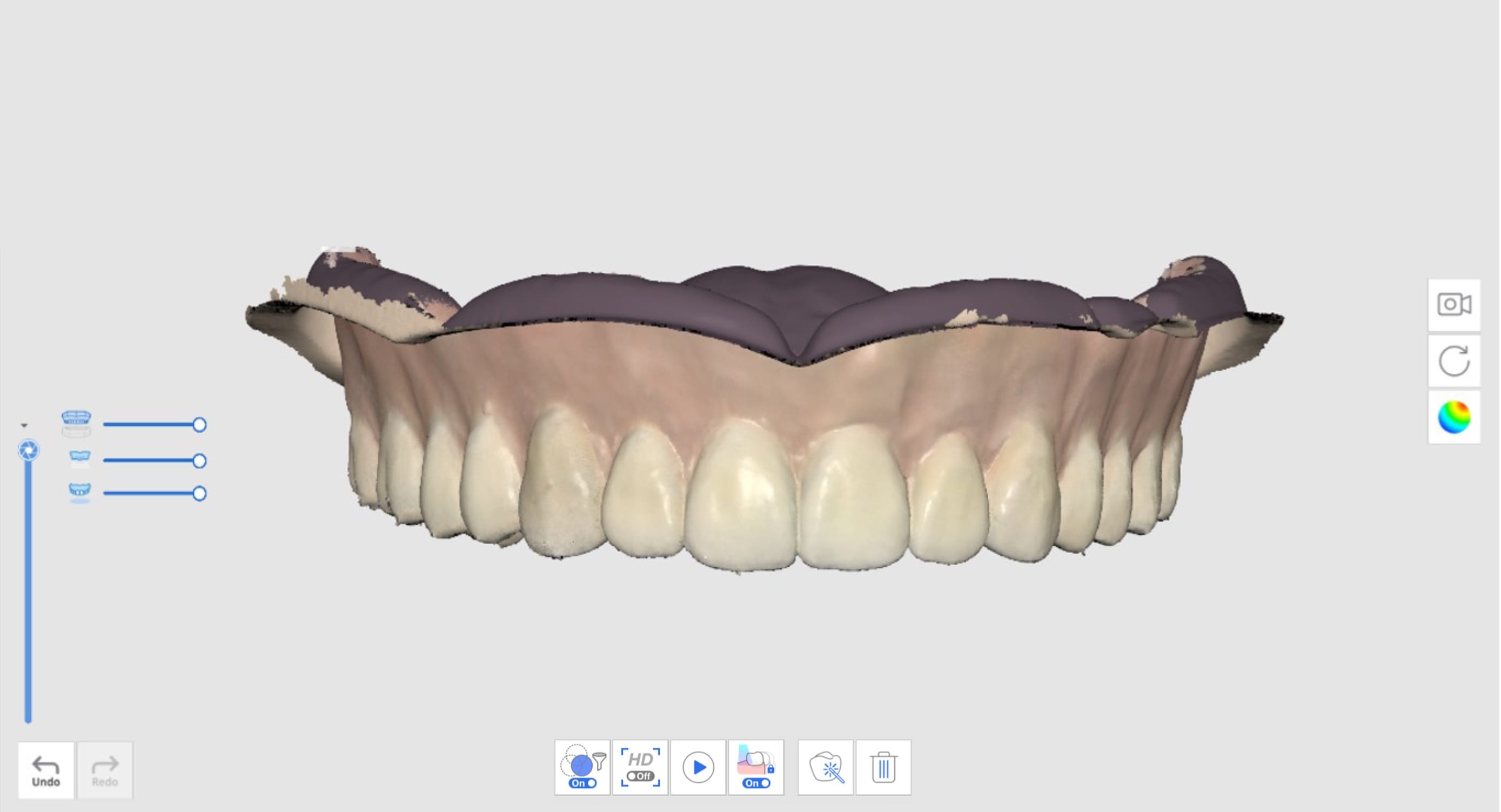 📖 Denture Scan – Medit Help Center