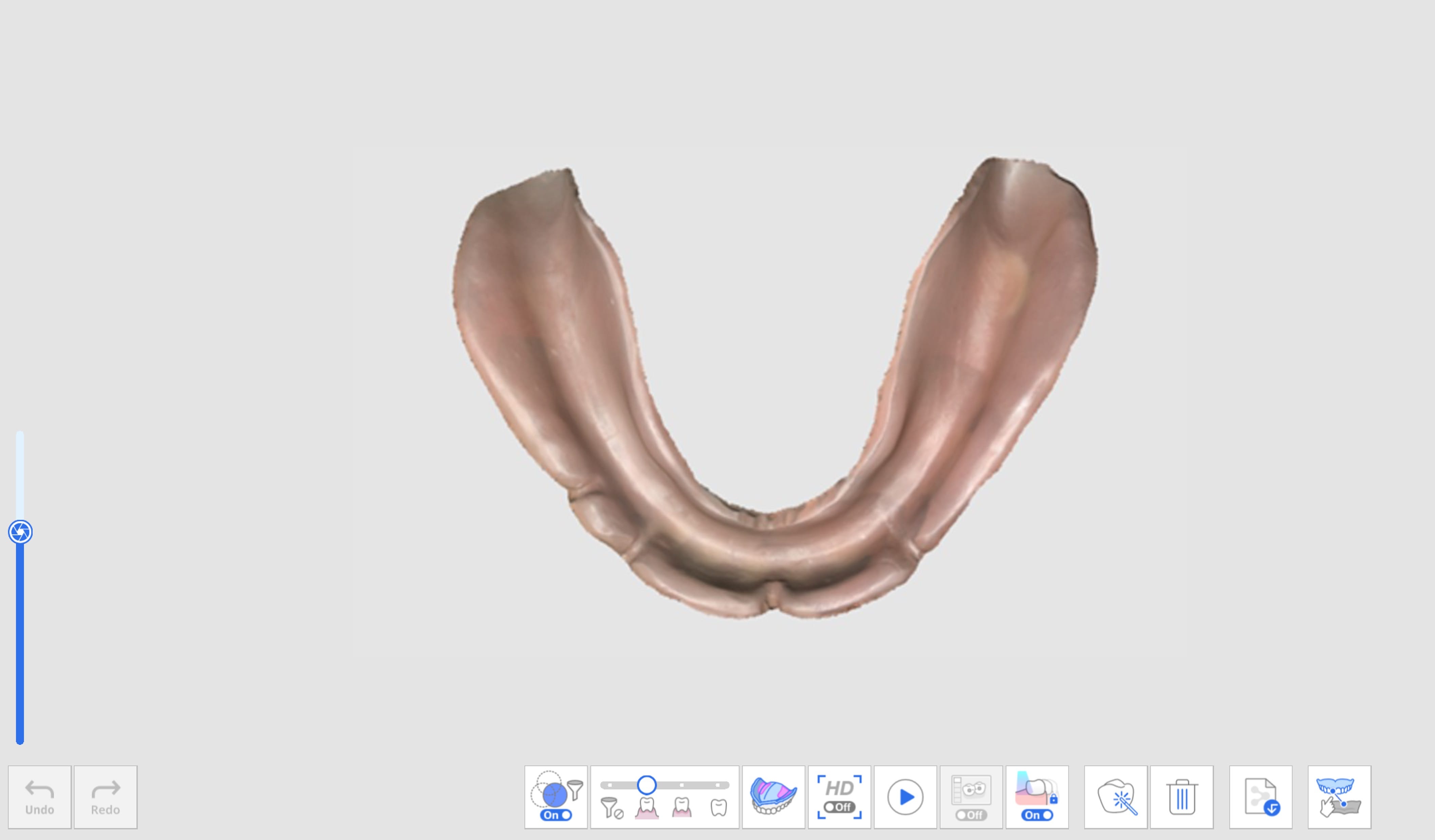 📖 Denture Scan – Medit Help Center