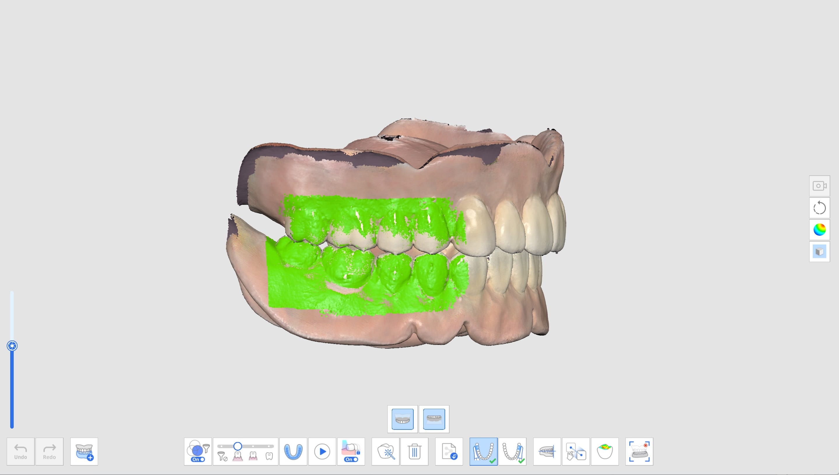 📖 Denture Scan – Medit Help Center