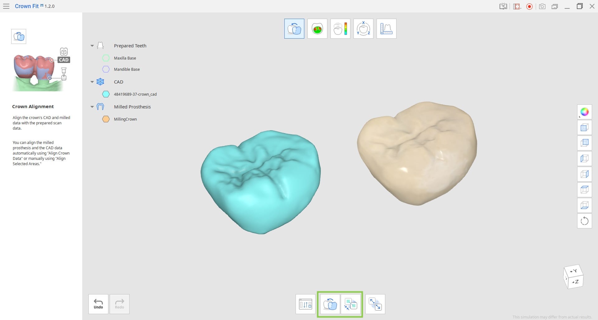 📖 Workflow > Crown Alignment – Medit Help Center