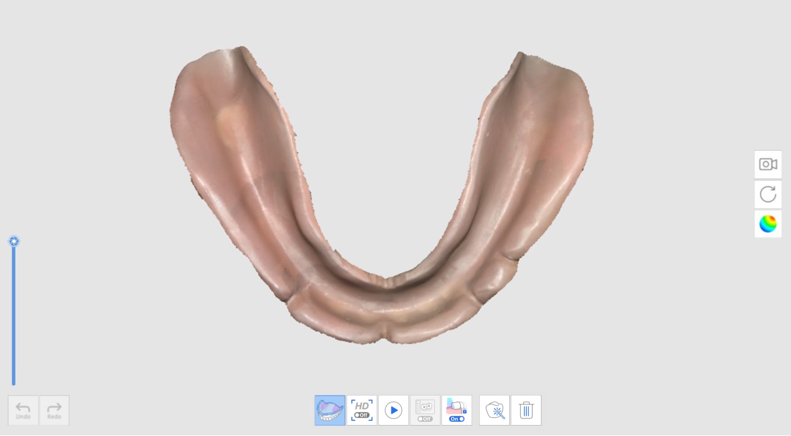 📖 Denture Scan – Medit Help Center