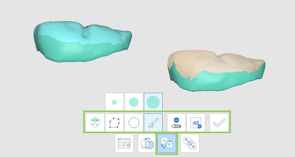 📖 Workflow > Crown Alignment – Medit Help Center