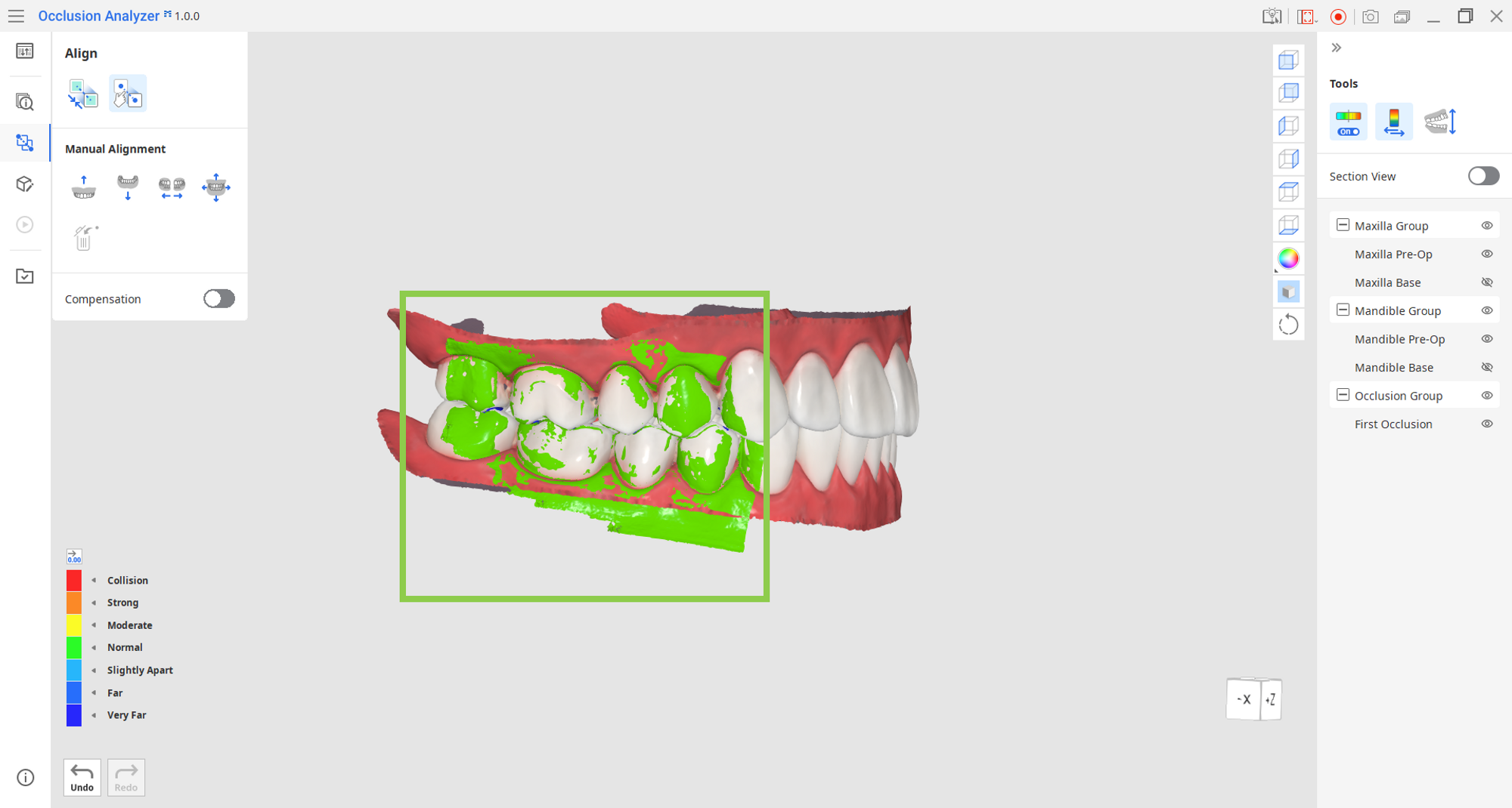 Alignment Mode – Medit Help Center