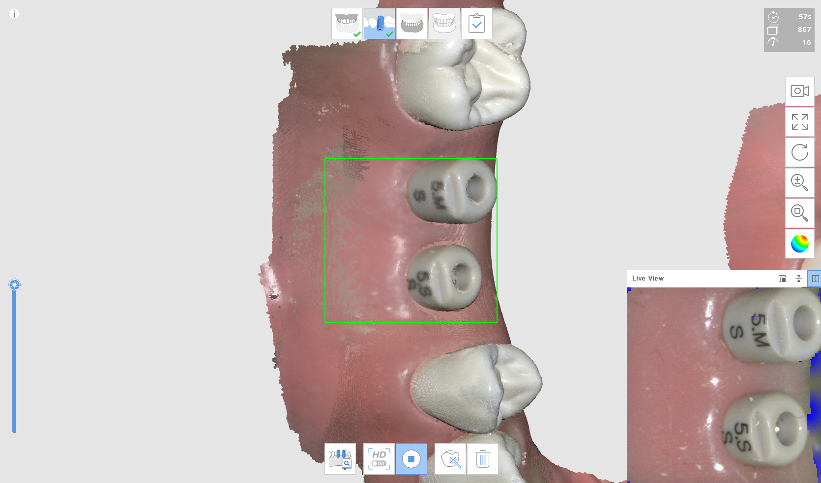 Scan body – Medit Help Center