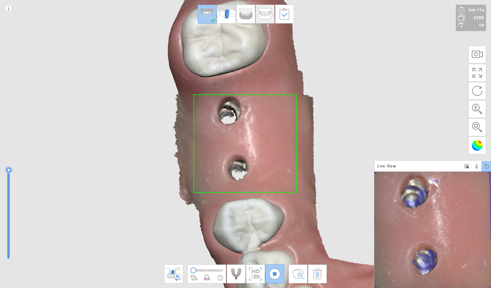 Scan body – Medit Help Center