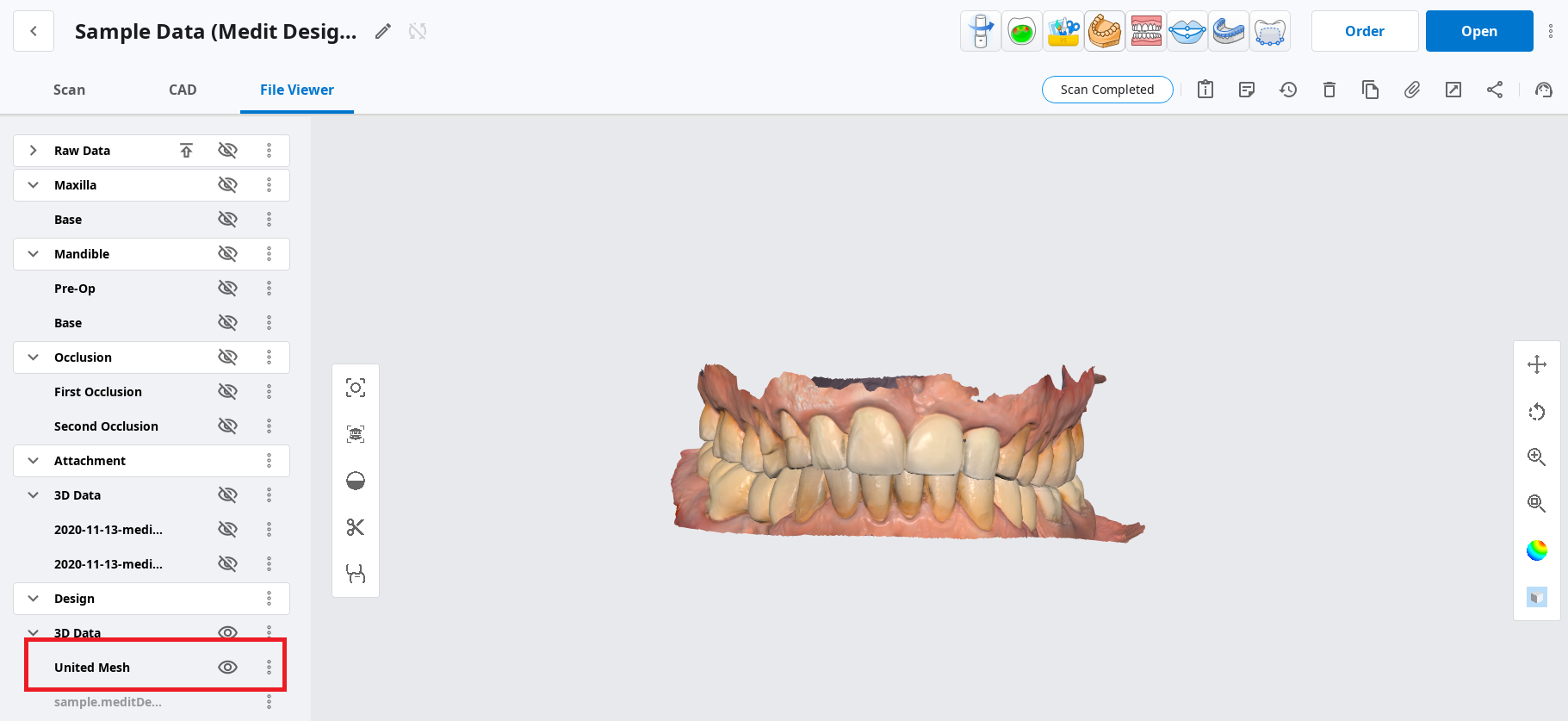 Medit Design > Combining two or more scan data sets into one – Medit ...