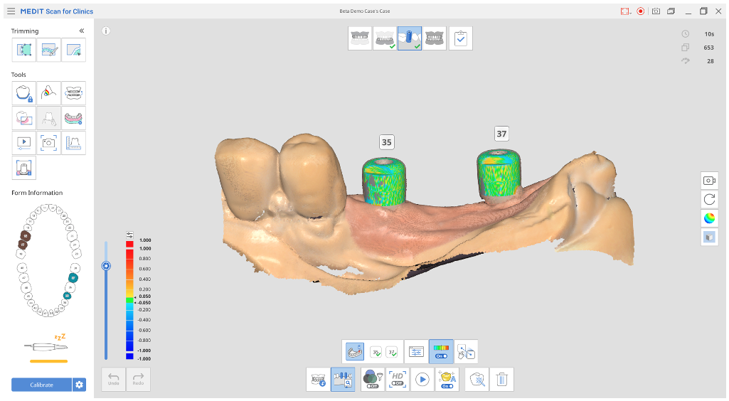 A.I. scanbody matching – Medit Help Center
