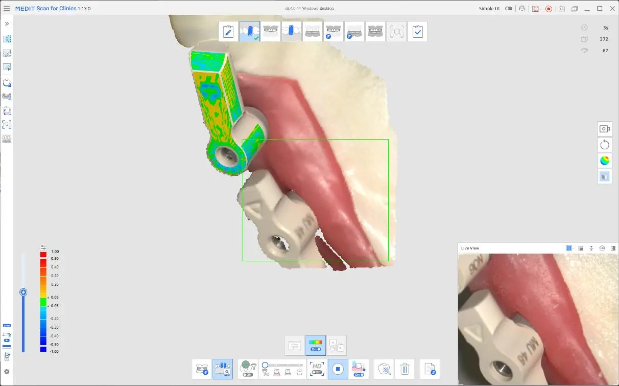 📖 SmartX Workflow – Medit Help Center