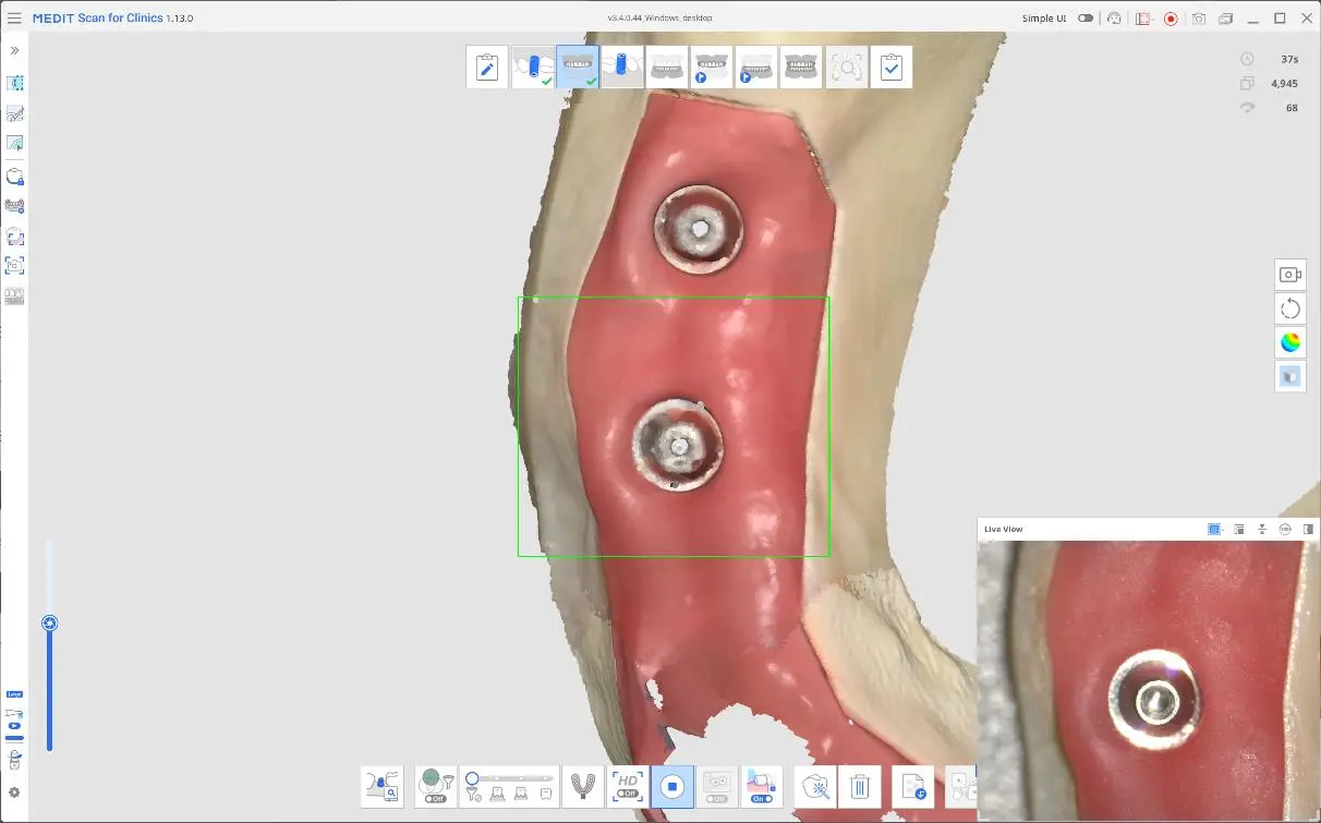 📖 SmartX Workflow – Medit Help Center