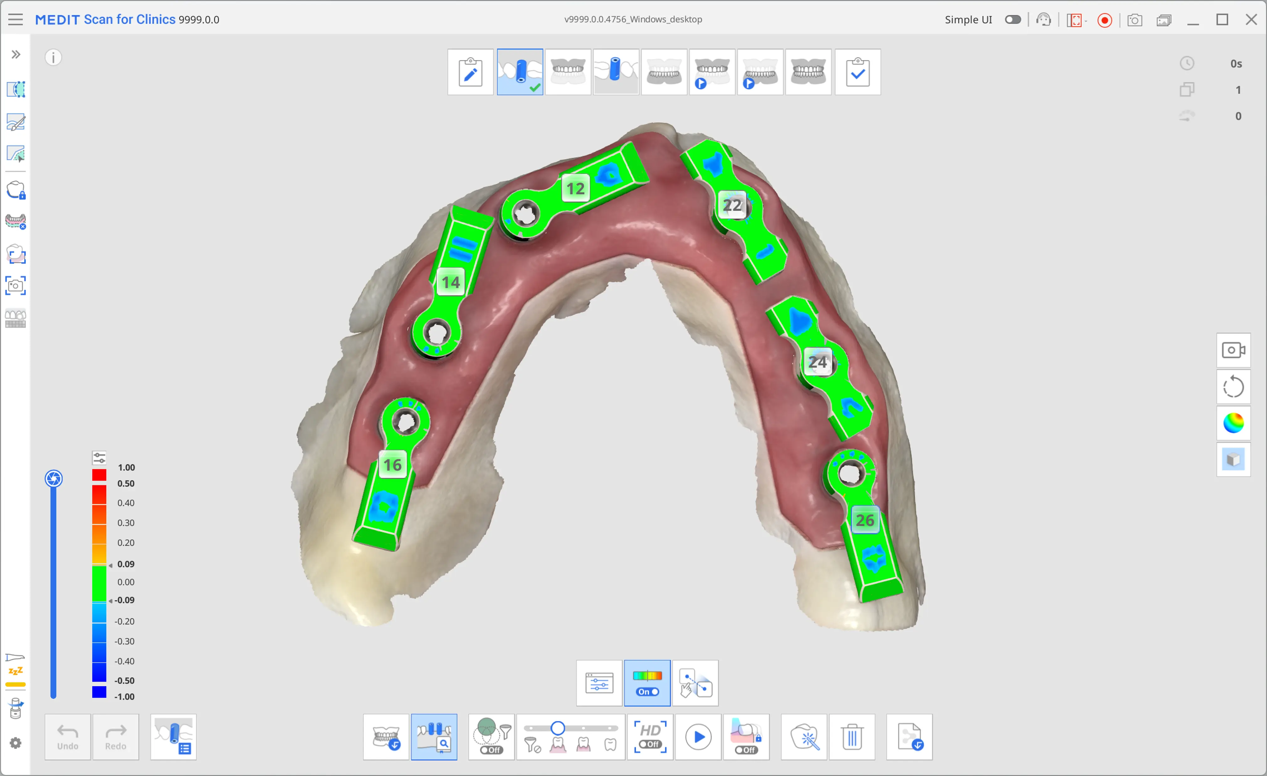 📖 SmartX Workflow – Medit Help Center