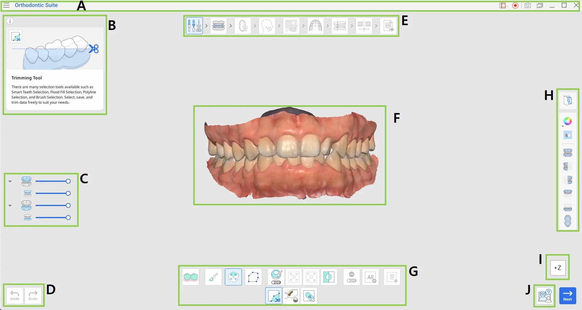 📖 User Interface – 메디트 고객지원센터