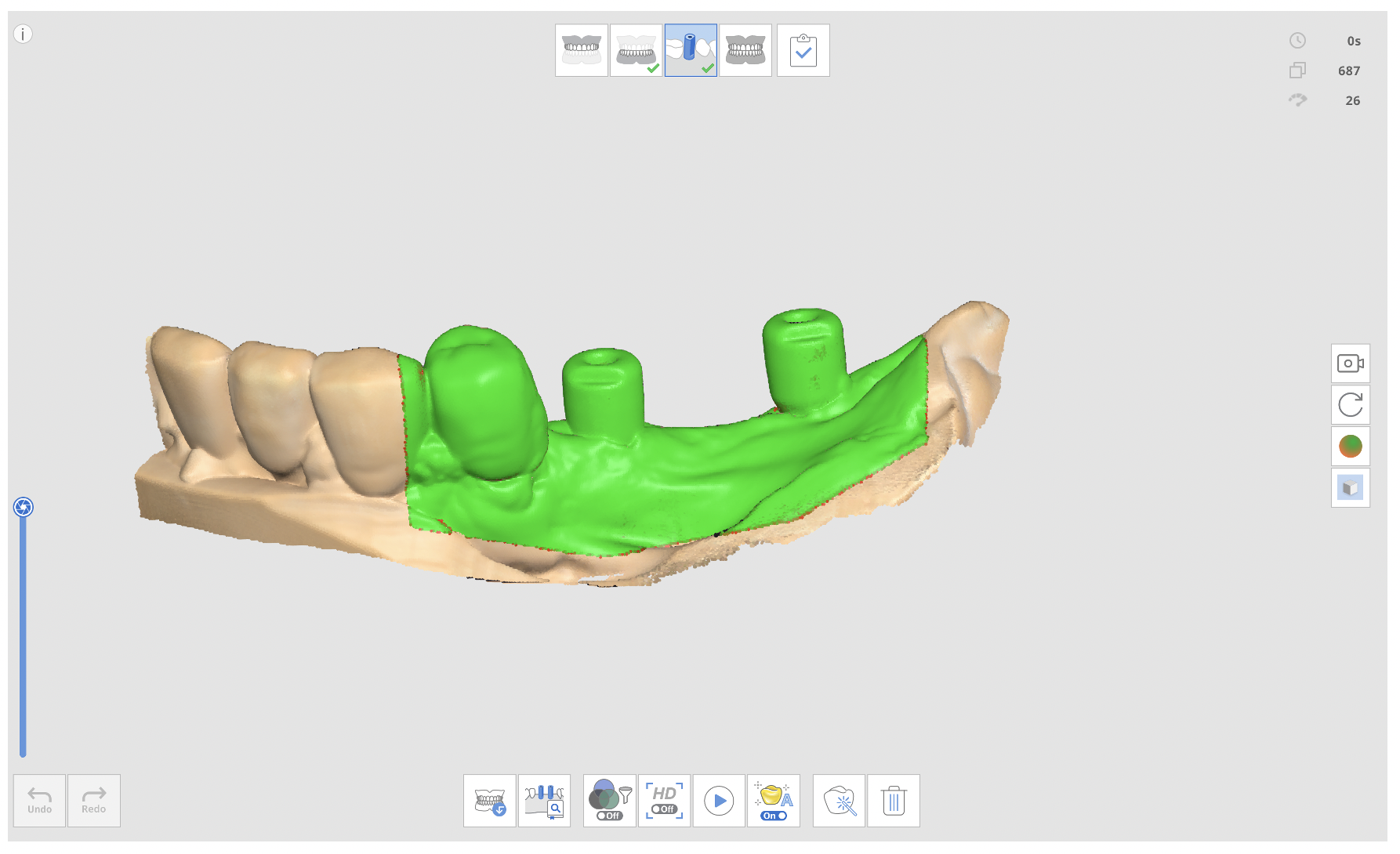 replicate-data-to-the-scan-body-stage-medit-help-center